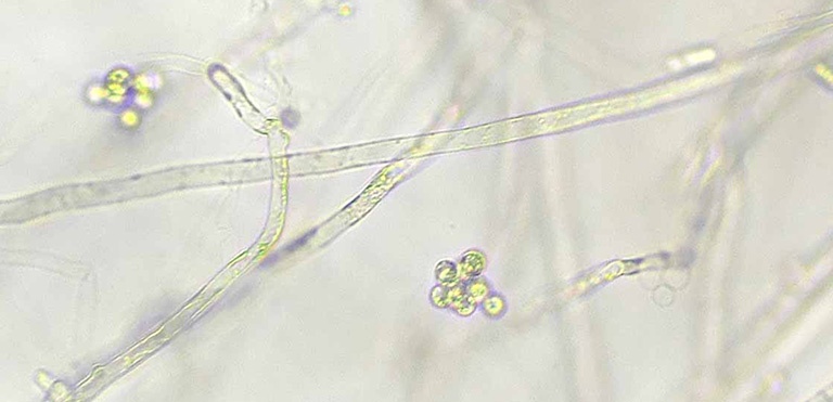 Crayfish plague | Aphanomyces astaci | Factsheet